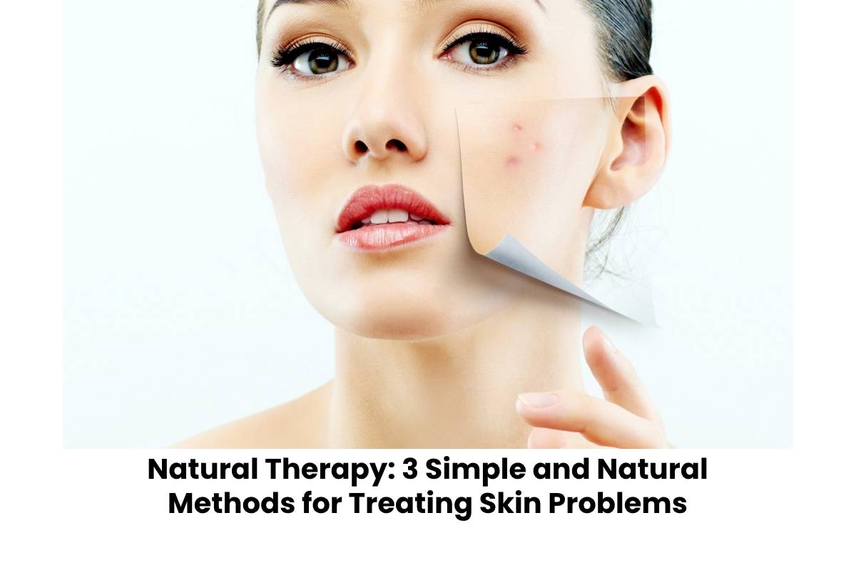 3 Simple and Natural Methods for Treating Skin Problem